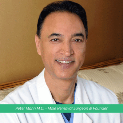Meet Dr. Mole™ - The Mole Doctor™ | Let’s be Healthy and Confident